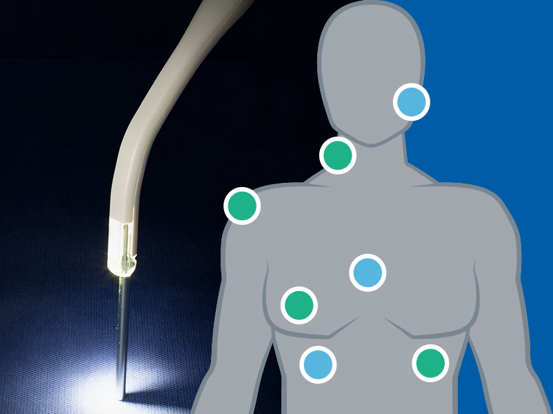 VersaLight | Surgical Light with Suction and Irrigation in one Handheld ...